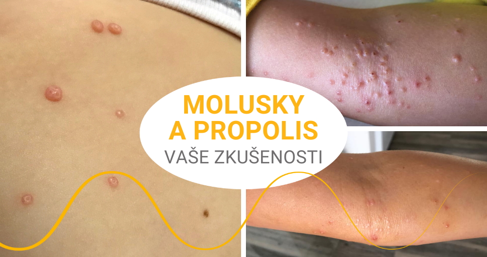 Propolis a molusky - zkušenosti našich zákazníků | Pleva
