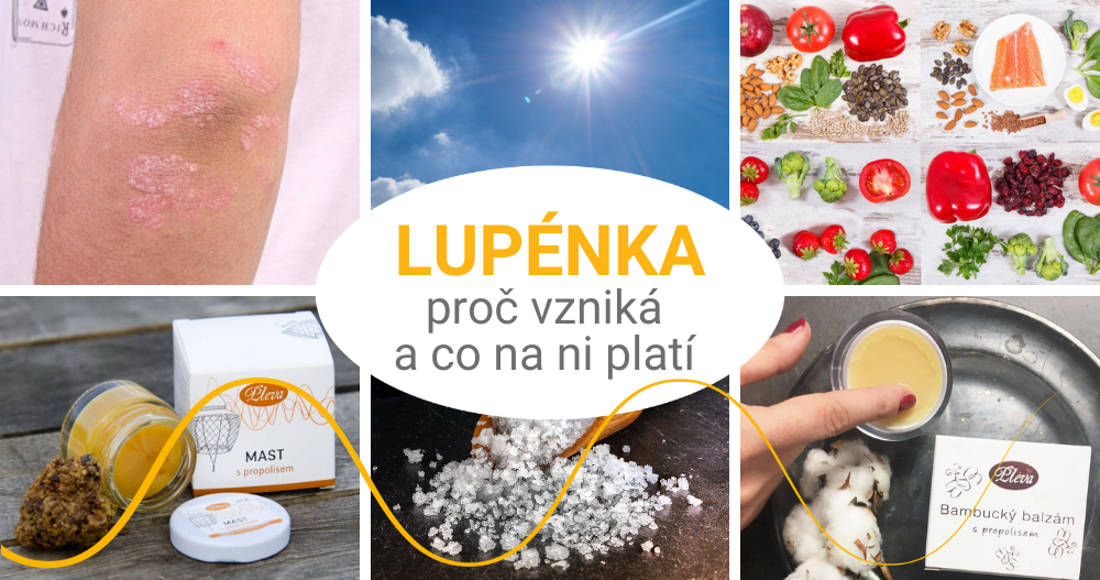 Lupénka – proč vzniká a jaké jsou možnosti léčby | Pleva